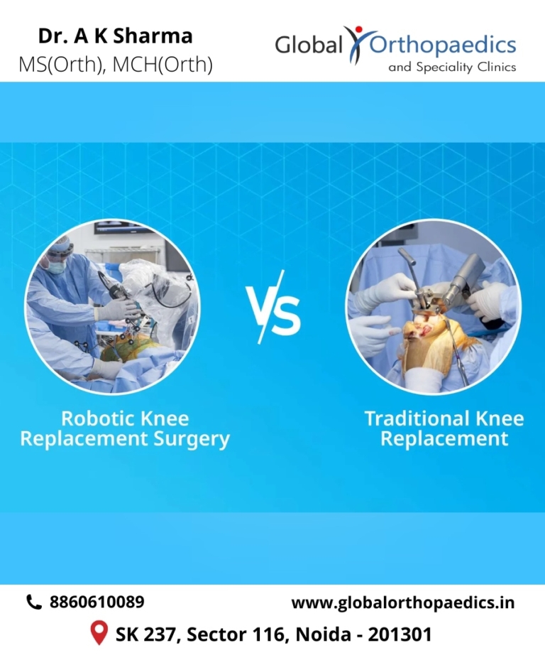 Robotic vs. Traditional Knee Replacement Surgery: Choosing the Right ...